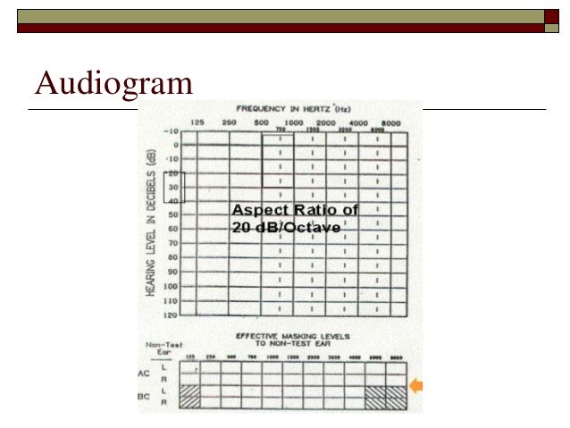Introduction to Basic Audiology