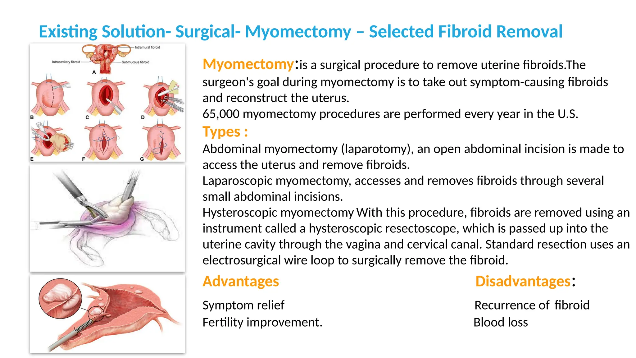 fibroid imaging and treatment options | PPTX