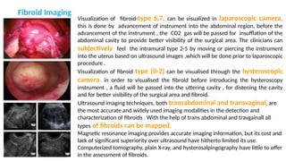 fibroid imaging and treatment options | PPTX