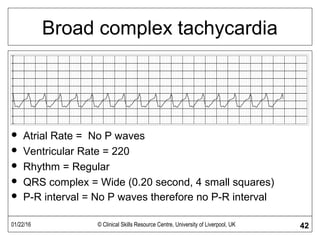Intro to ECG | PPT