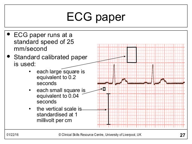 Intro to ECG