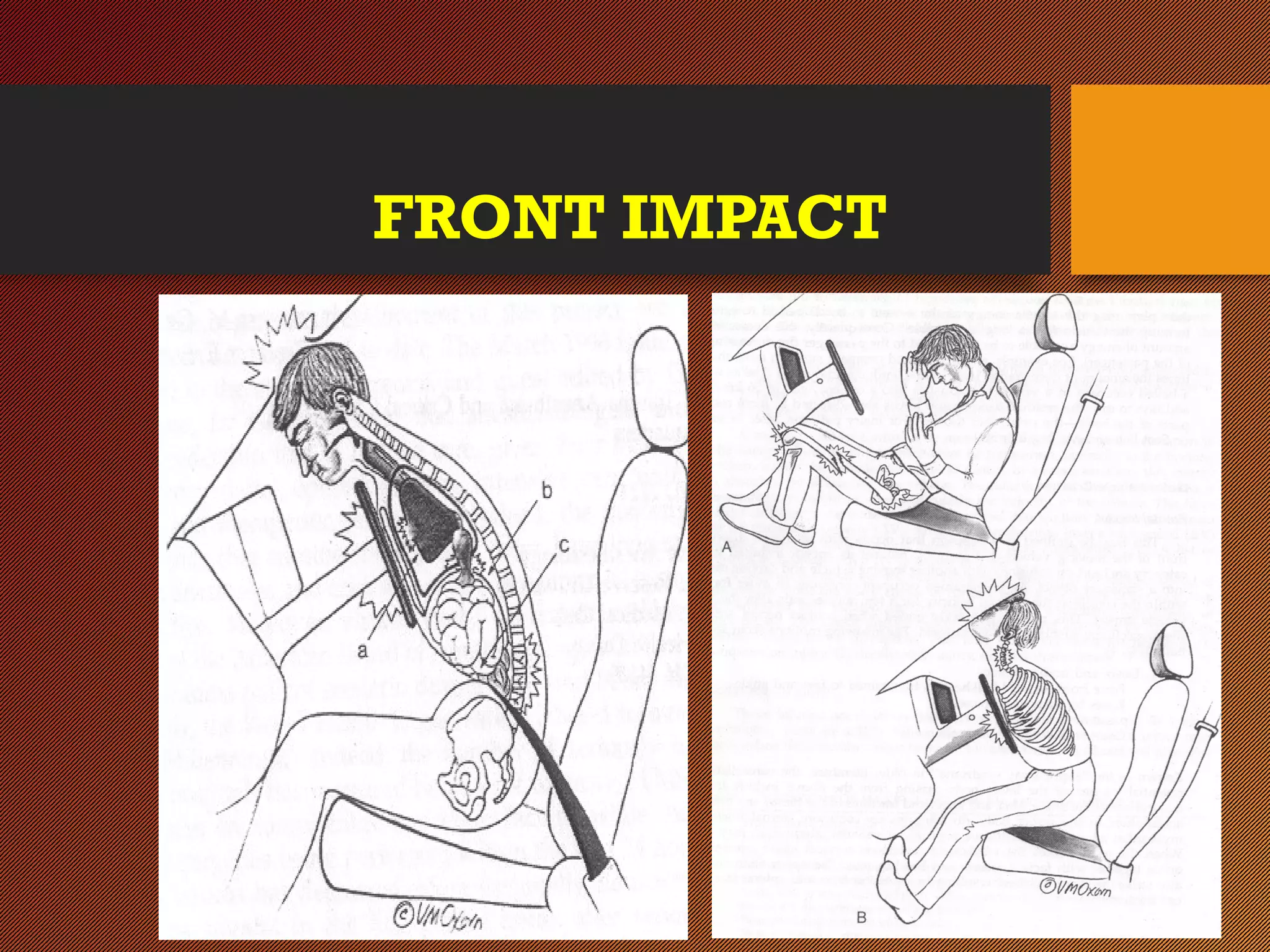 ATLS- Advanced Trauma Life Support | PPT