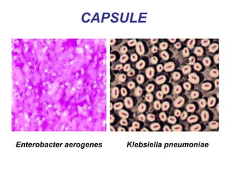 Enterobacter Aerogenes Negative Stain