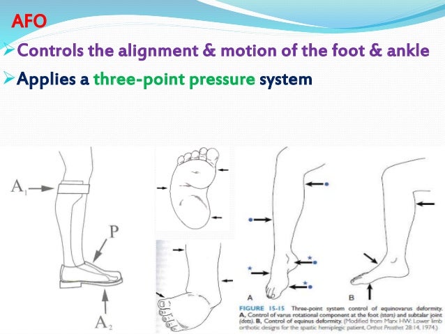 Introd &ll orthosis dr.aliaa