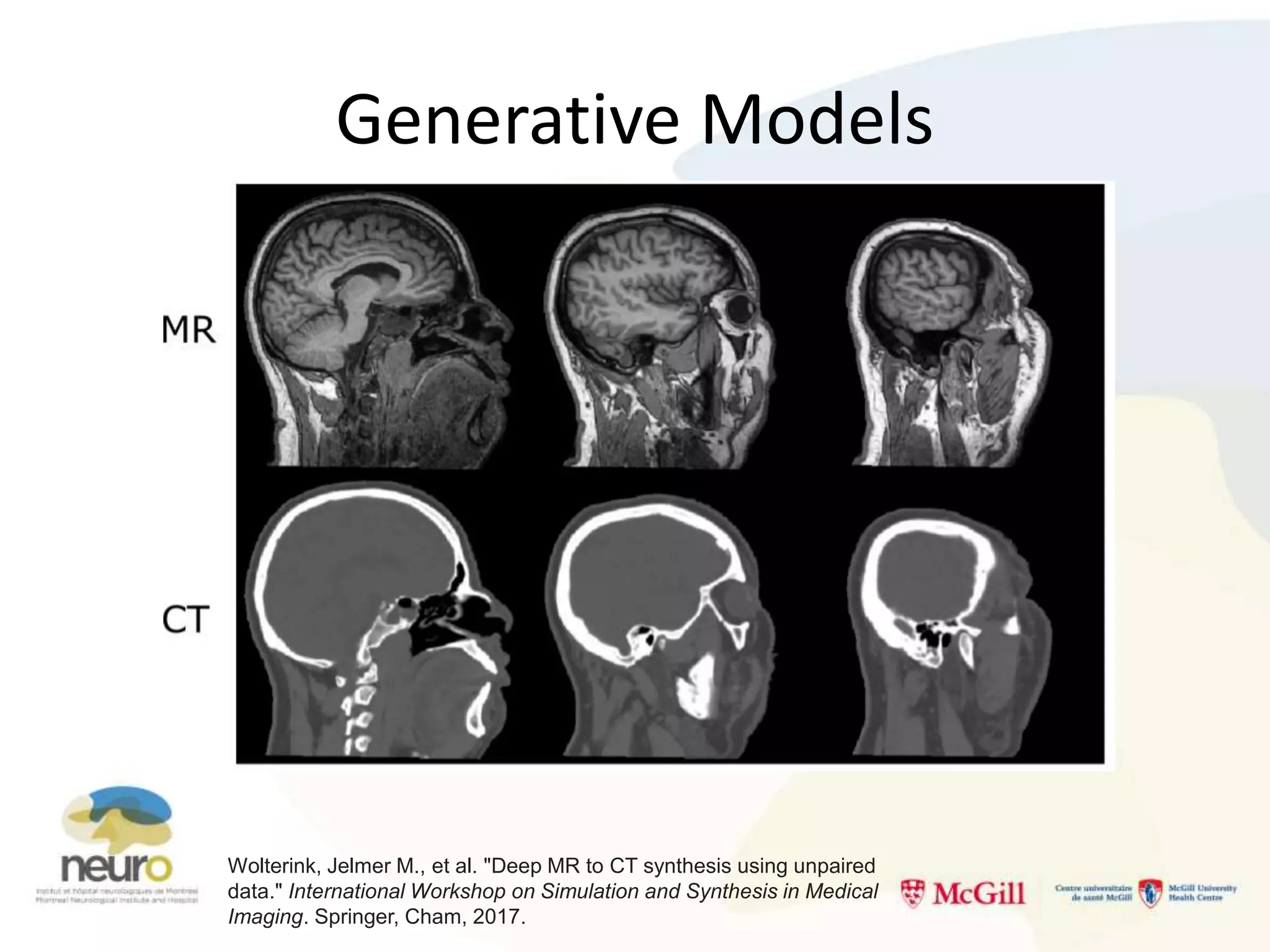 Introduction to Deep Learning for Neuroimaging | PPTX