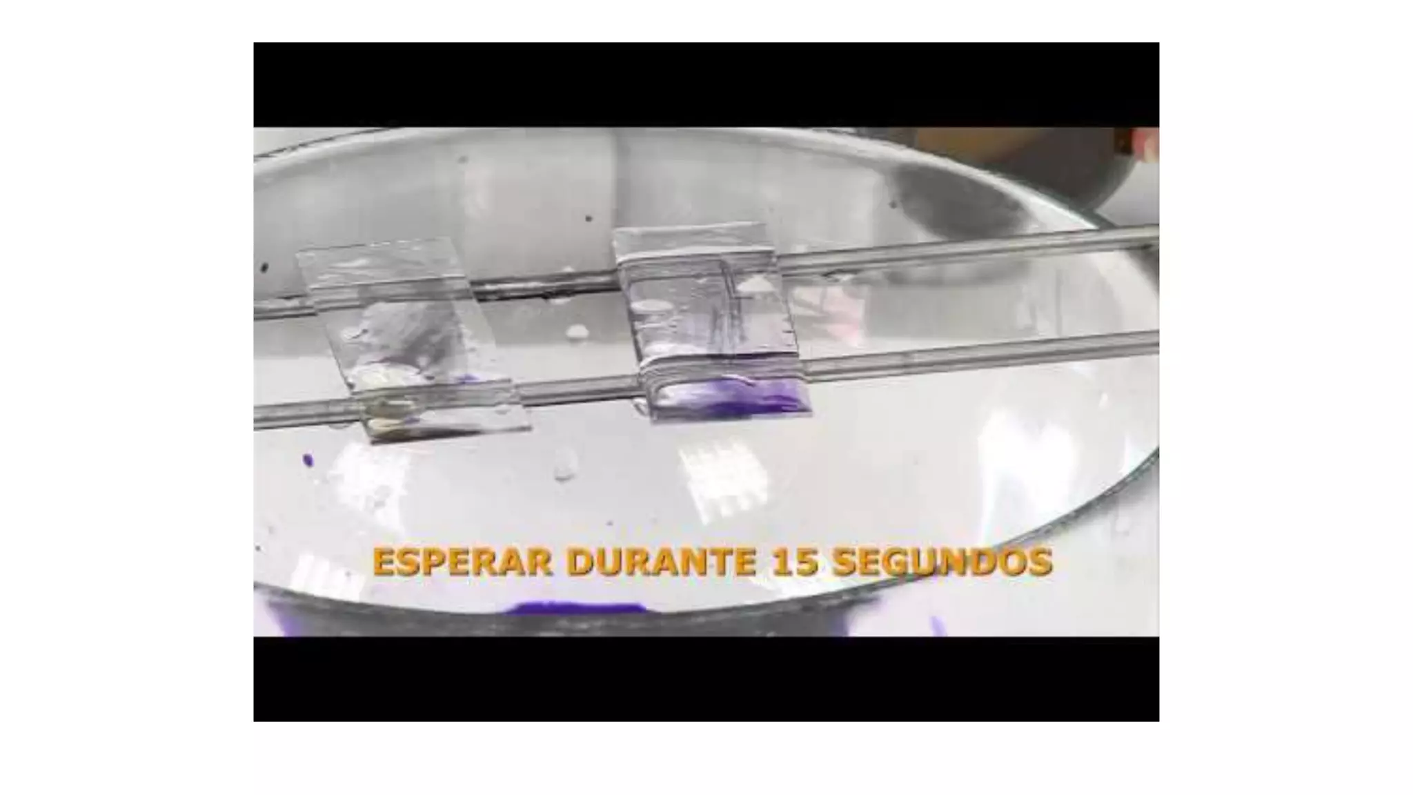 Introducción A La Bacteriología Ppt