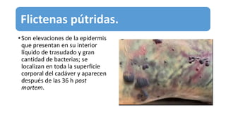 Introducción A La Medicina Forense Pdf