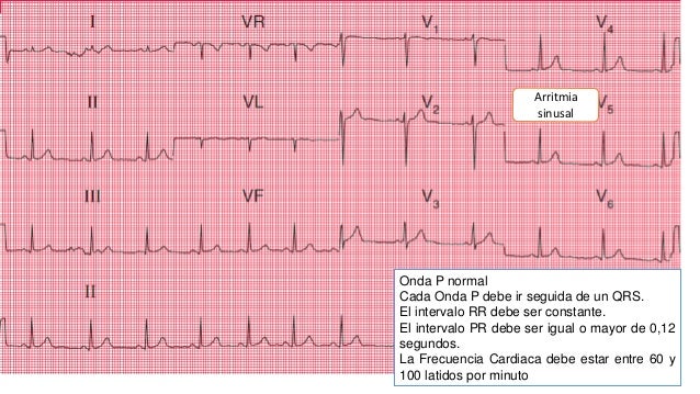 Introducción ekg