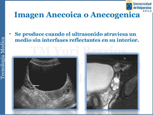 Introduccion a la ecotomografia musculo esqueletica