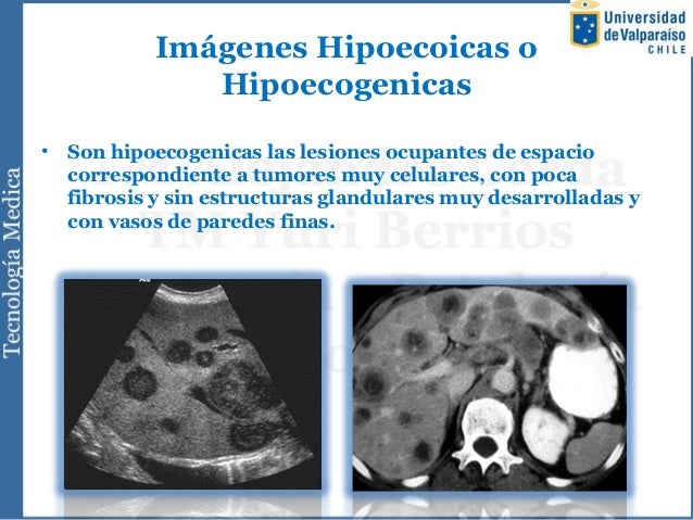 Introduccion a la ecotomografia musculo esqueletica