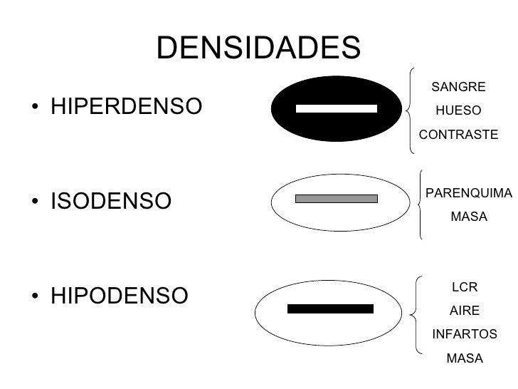 Introduccion a la neuroradiologia