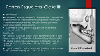 introducción a la planificación en cirugía ortognatica | PPTX