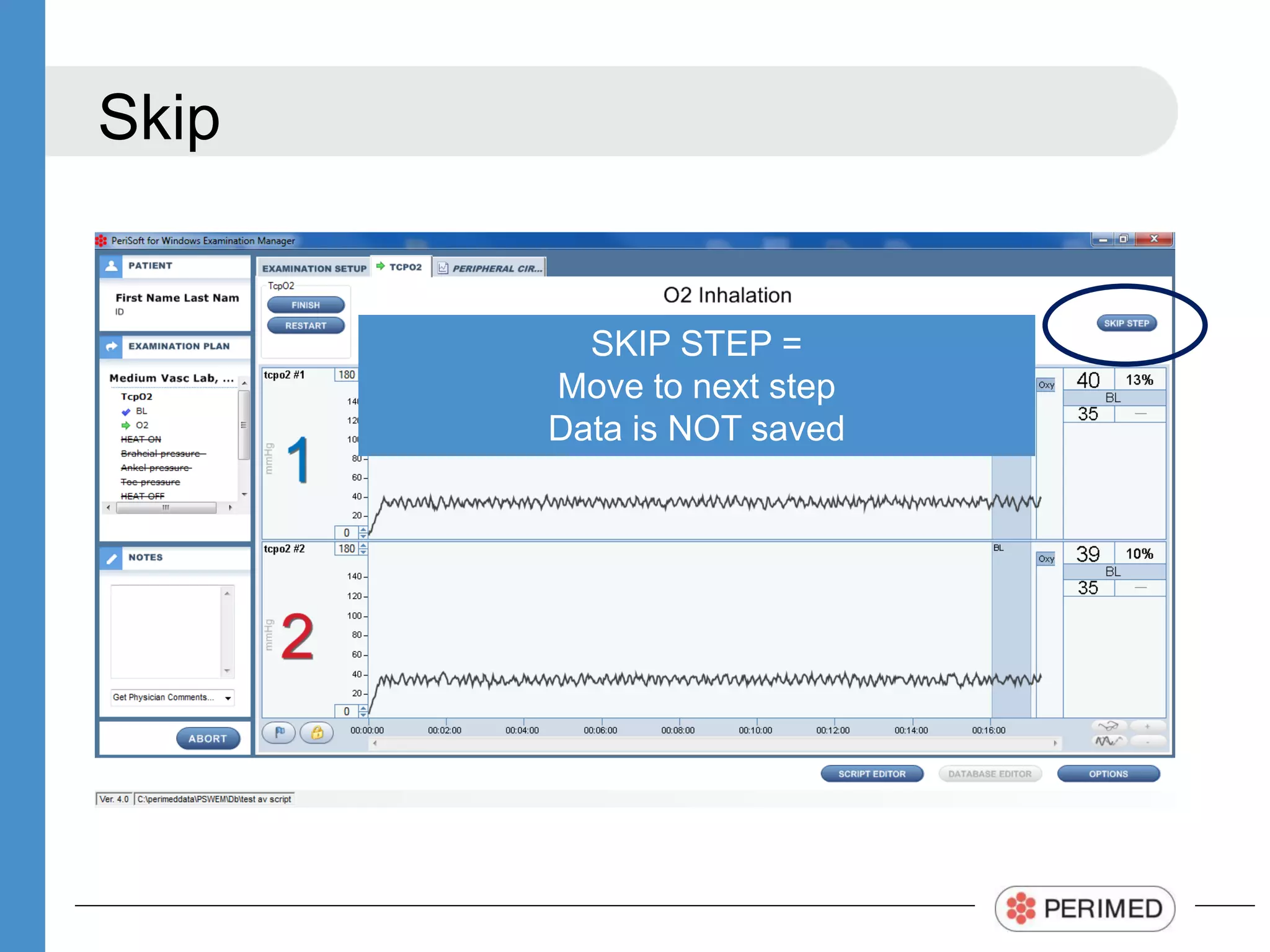 New Vascular Lab software from Perimed, PSW ExM 4.1 | PDF