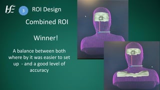 Introducing AlignRT for head and neck IMRT treatments | PPT