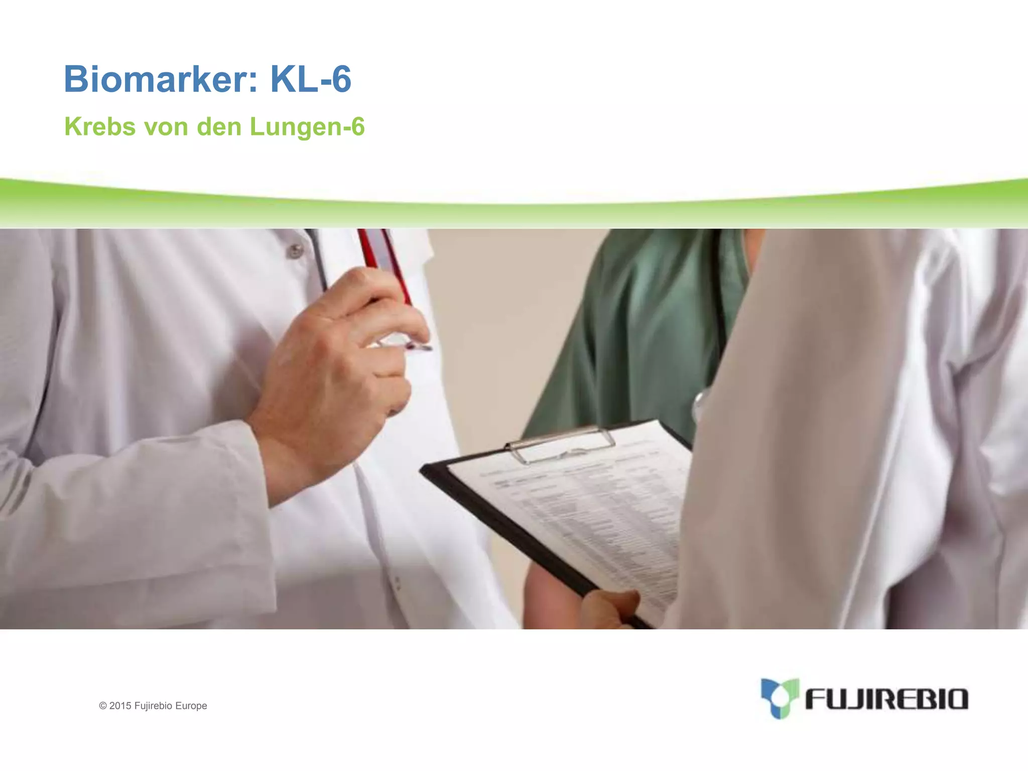 Introducing the KL-6 biomarker, an add-on marker for the diagnostic and ...