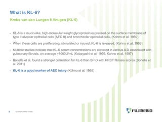 Introducing the KL-6 biomarker, an add-on marker for the diagnostic and ...