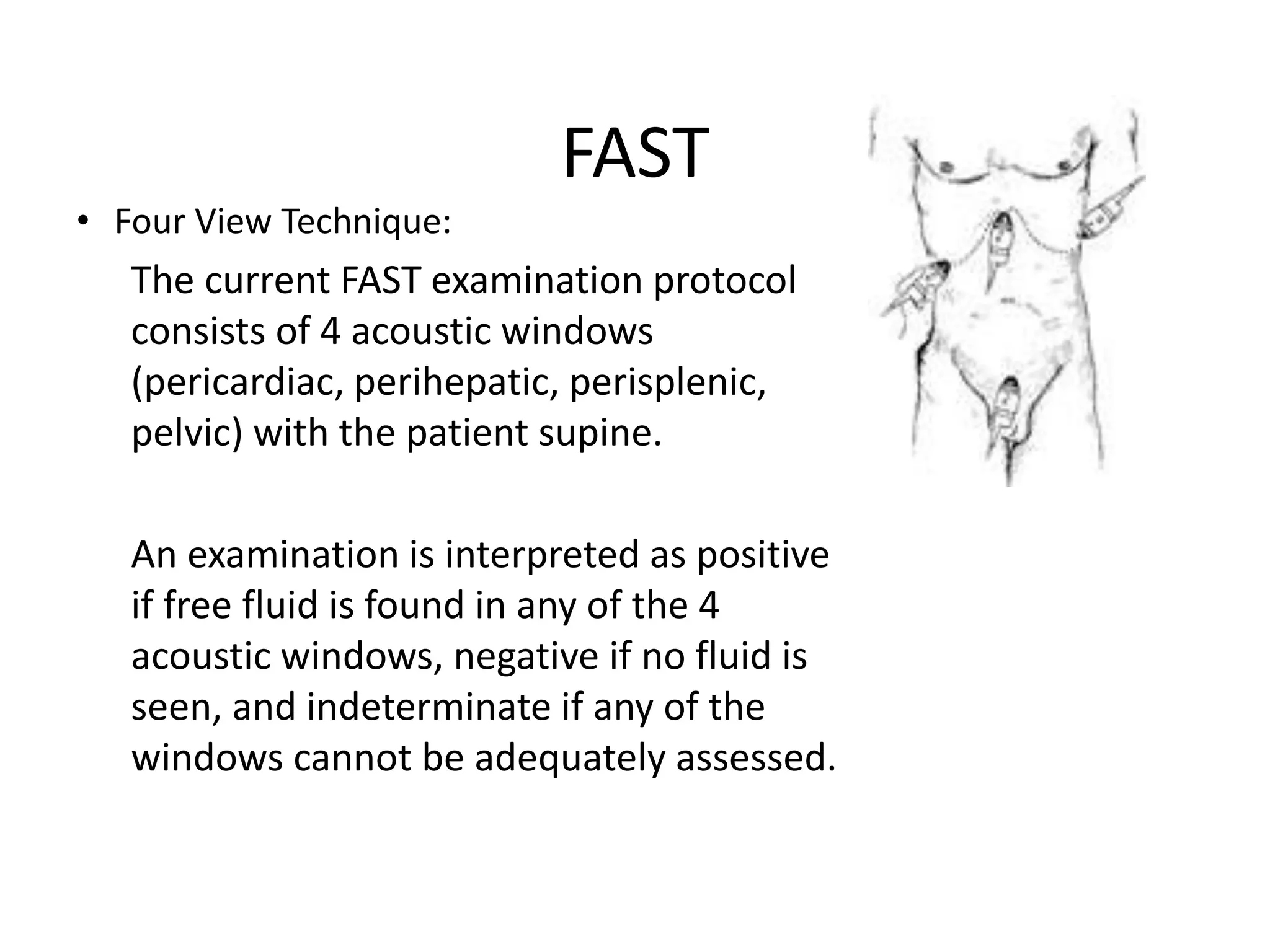 Abdominal trauma-Hamisi Mkindi | PPTX