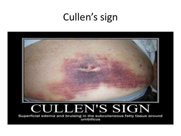 Abdominal trauma-Hamisi Mkindi