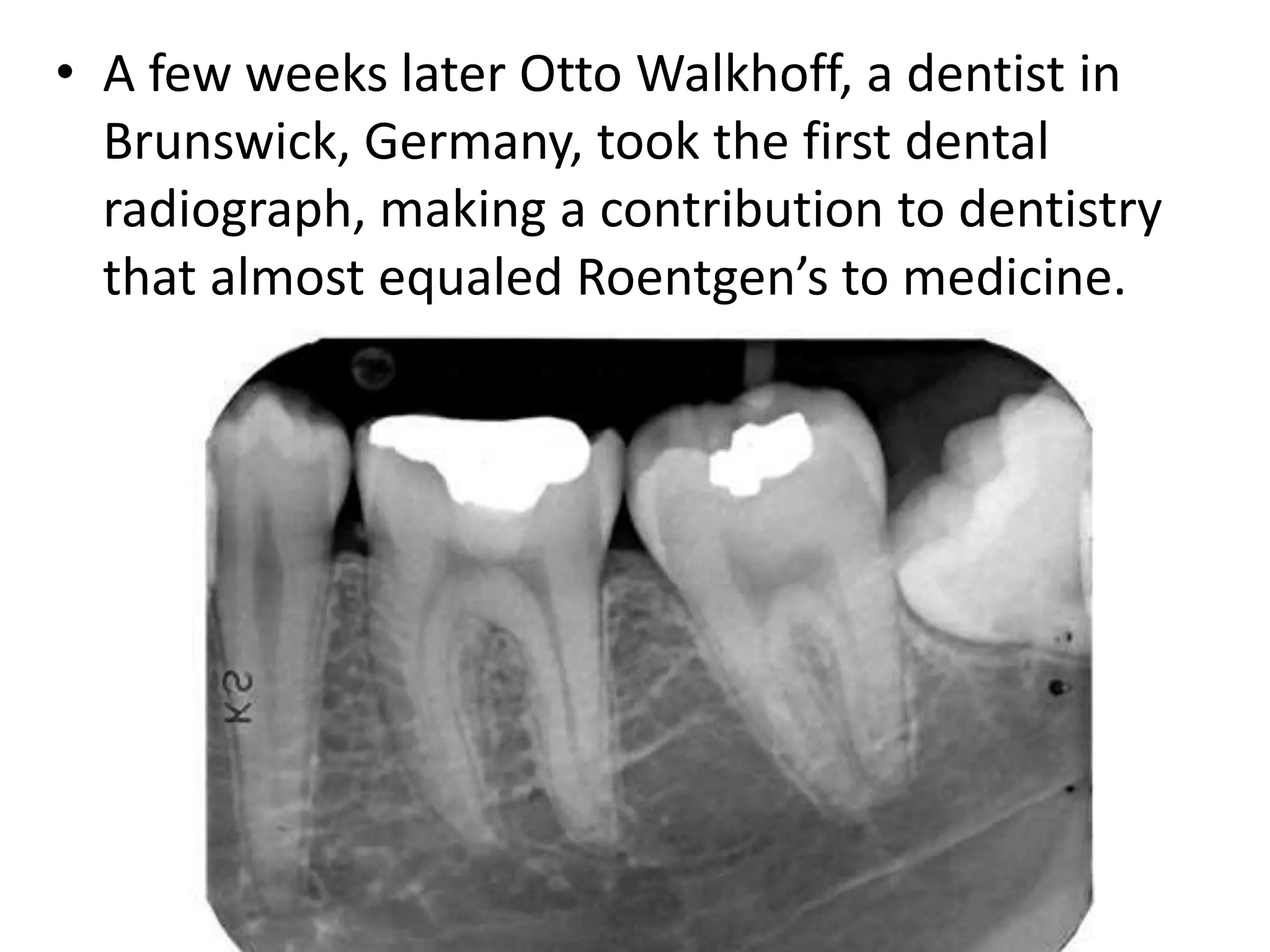 Introduction to Endodontics | PPTX