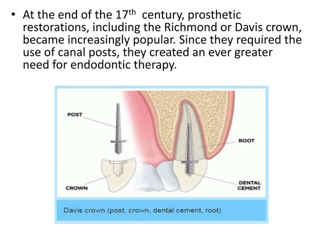 Introduction to Endodontics | PPTX | Dental Health | Diseases and Conditions