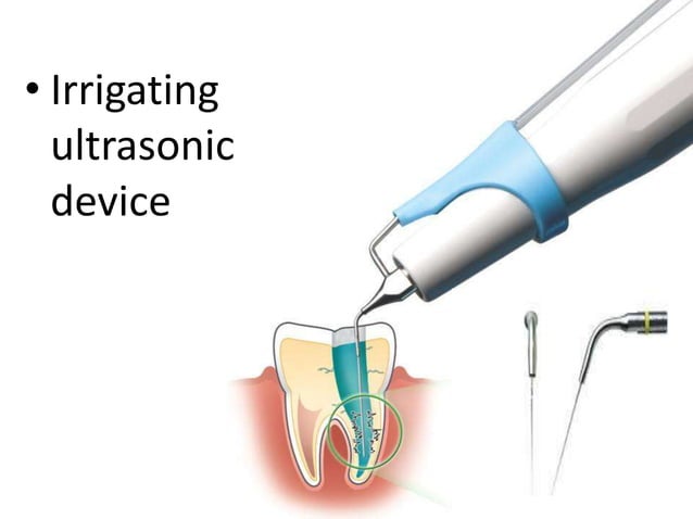 Introduction to Endodontics | PPTX | Dental Health | Diseases and Conditions