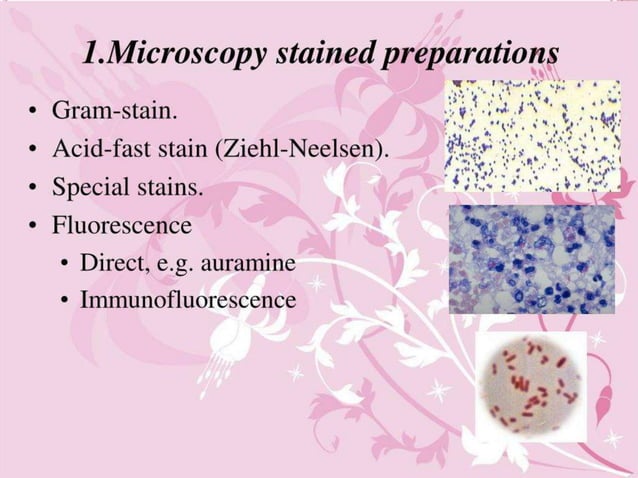 Introduction. to Systematic diagnostic bacteriology | PPTX | Infectious Diseases | Diseases and ...