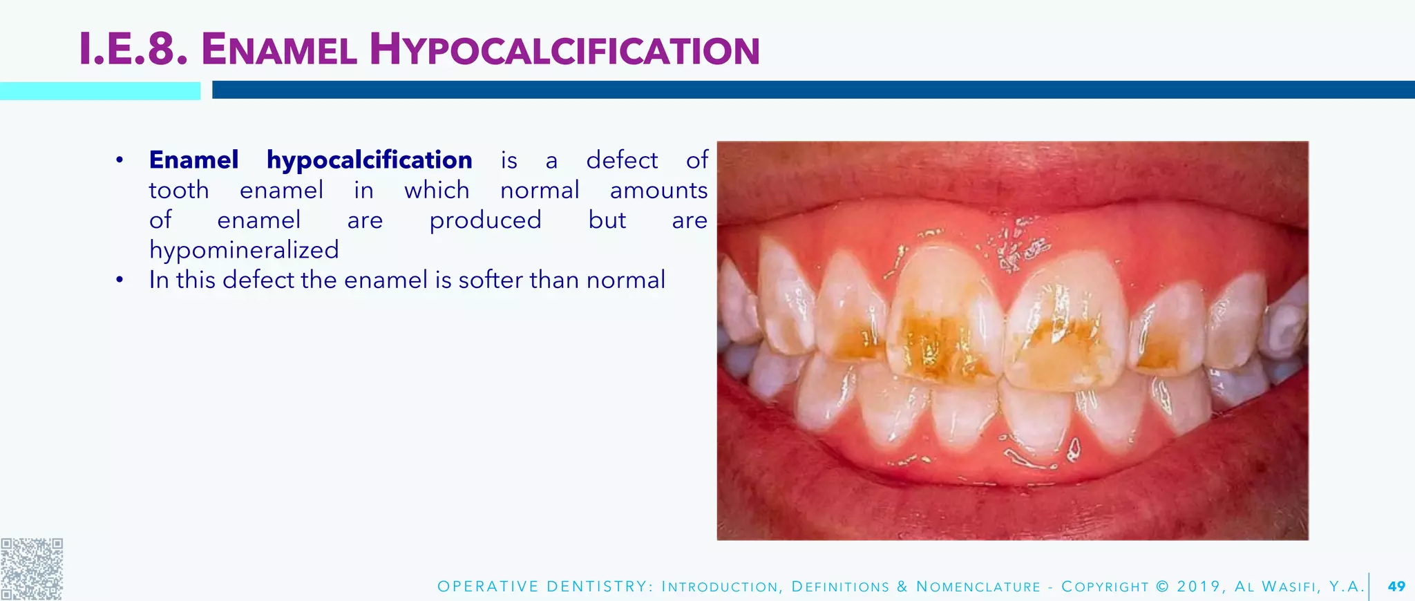Introduction to Operative Dentistry - 2019 | PDF