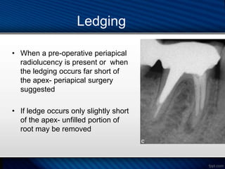 Surgical Endodontics | PPT