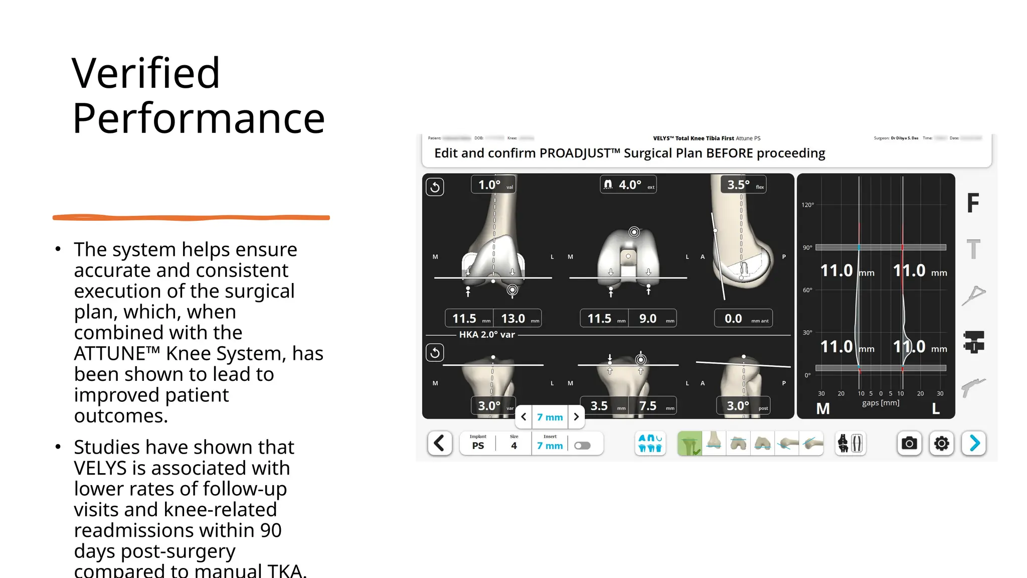 Introduction to velys robotic system.pptx