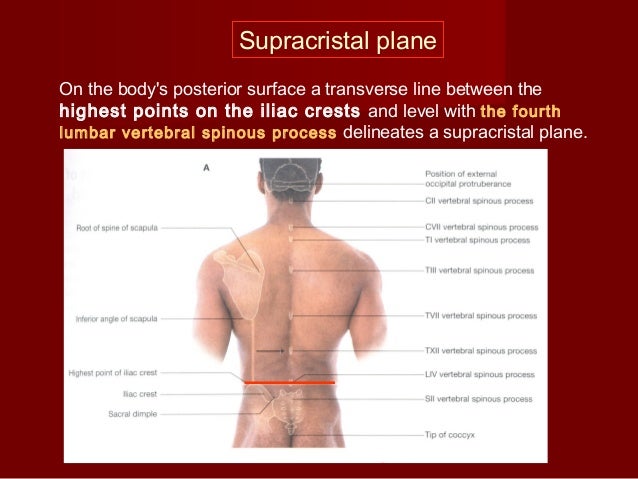 Subcostal Plane