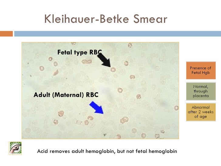 Introduction and Anemia 2007