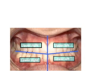 Introduction dental anatomy | PPT