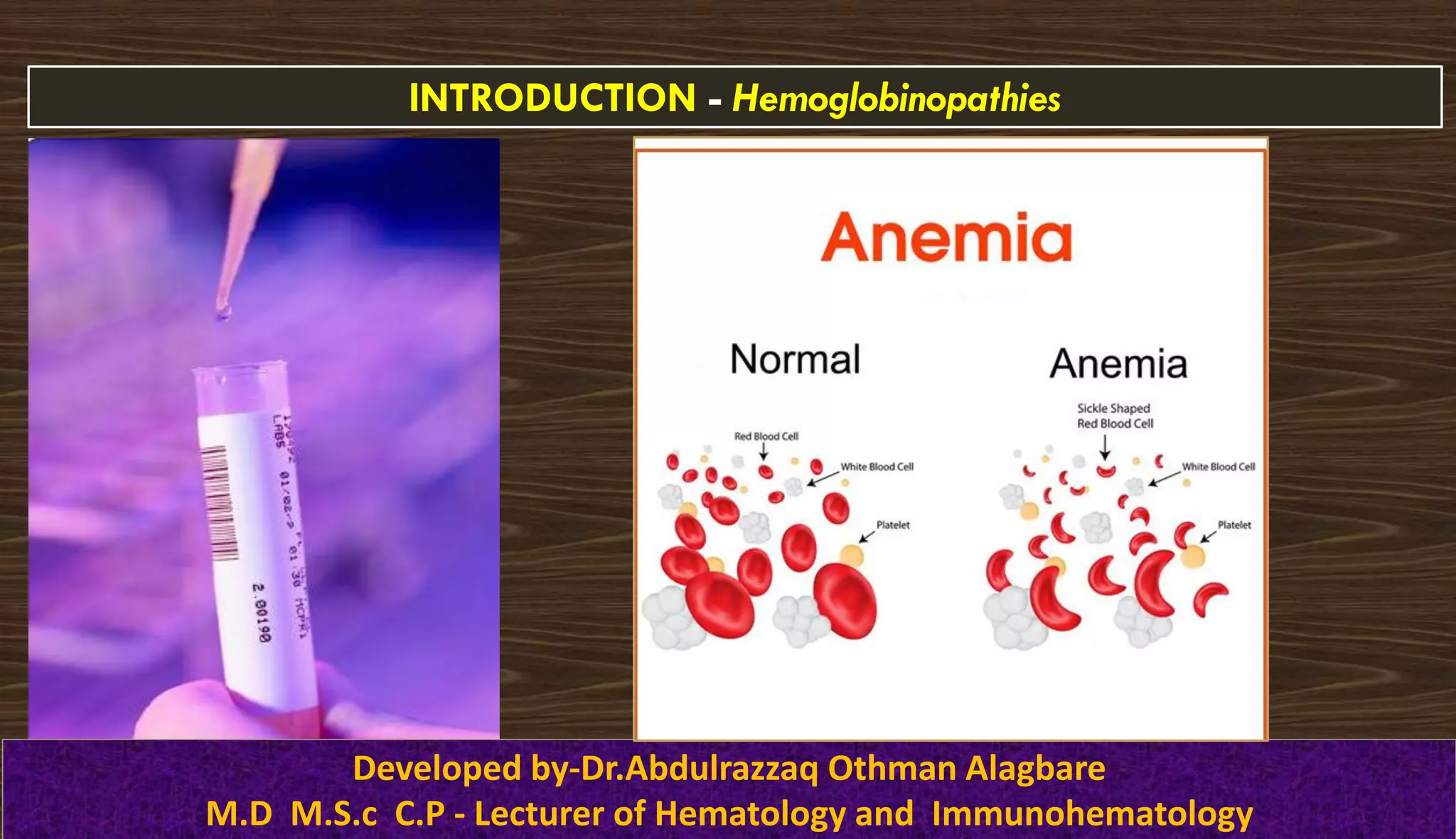 Introduction hemoglobinopathies | PDF