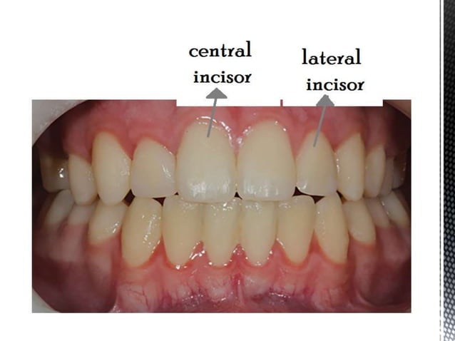 Introduction-of-Tooth.pptx