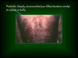 Introduction oral medicine-primary & sec lesions ( modify) | PPT | Skin ...