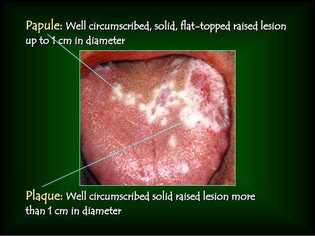 Introduction oral medicine-primary and secondary lesions