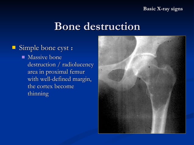 Introduction skeletal radiology(11月20.) | PPT