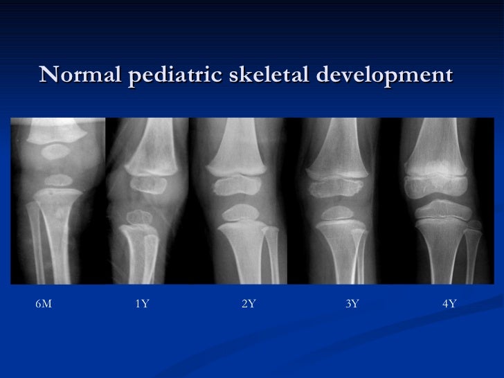 Introduction skeletal radiology(11月20.)