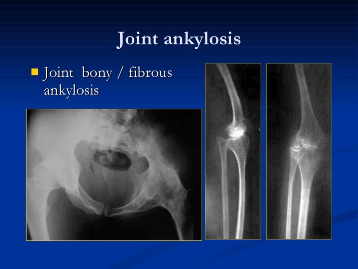 Introduction skeletal radiology(11月20.)
