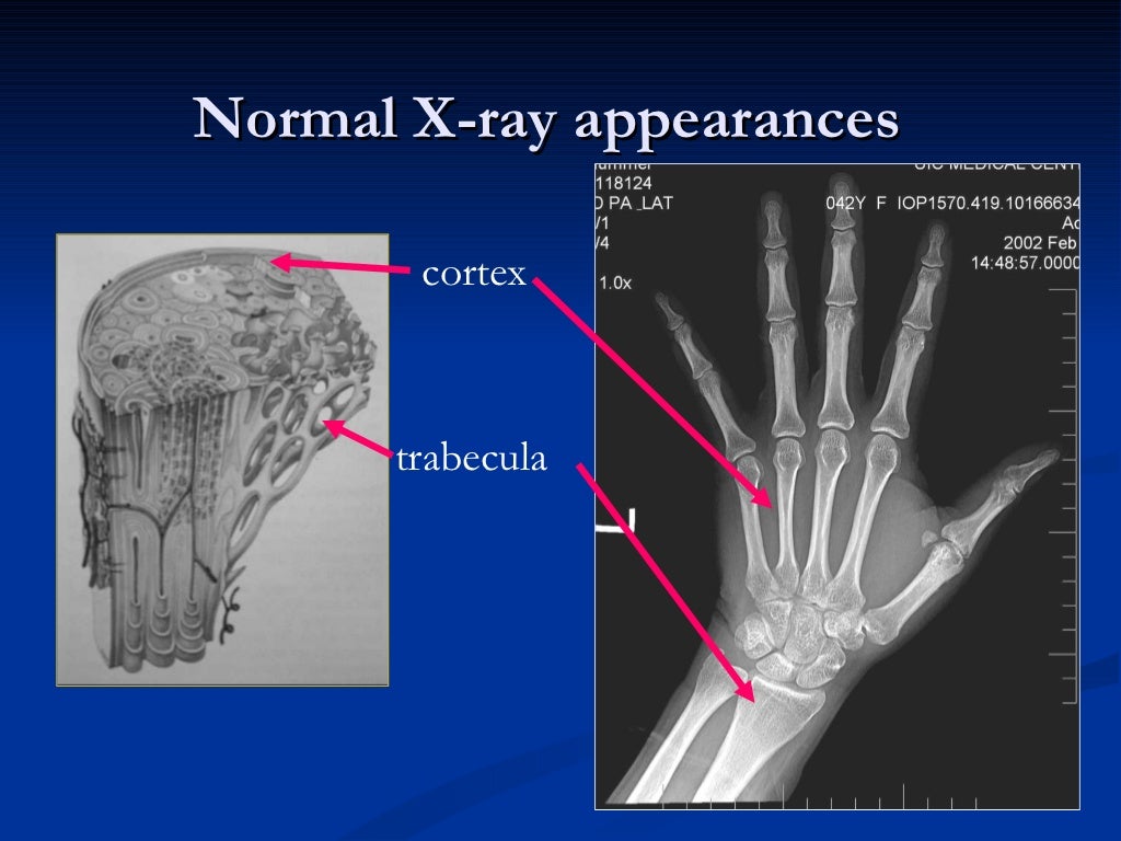 Introduction skeletal radiology(11月20.)