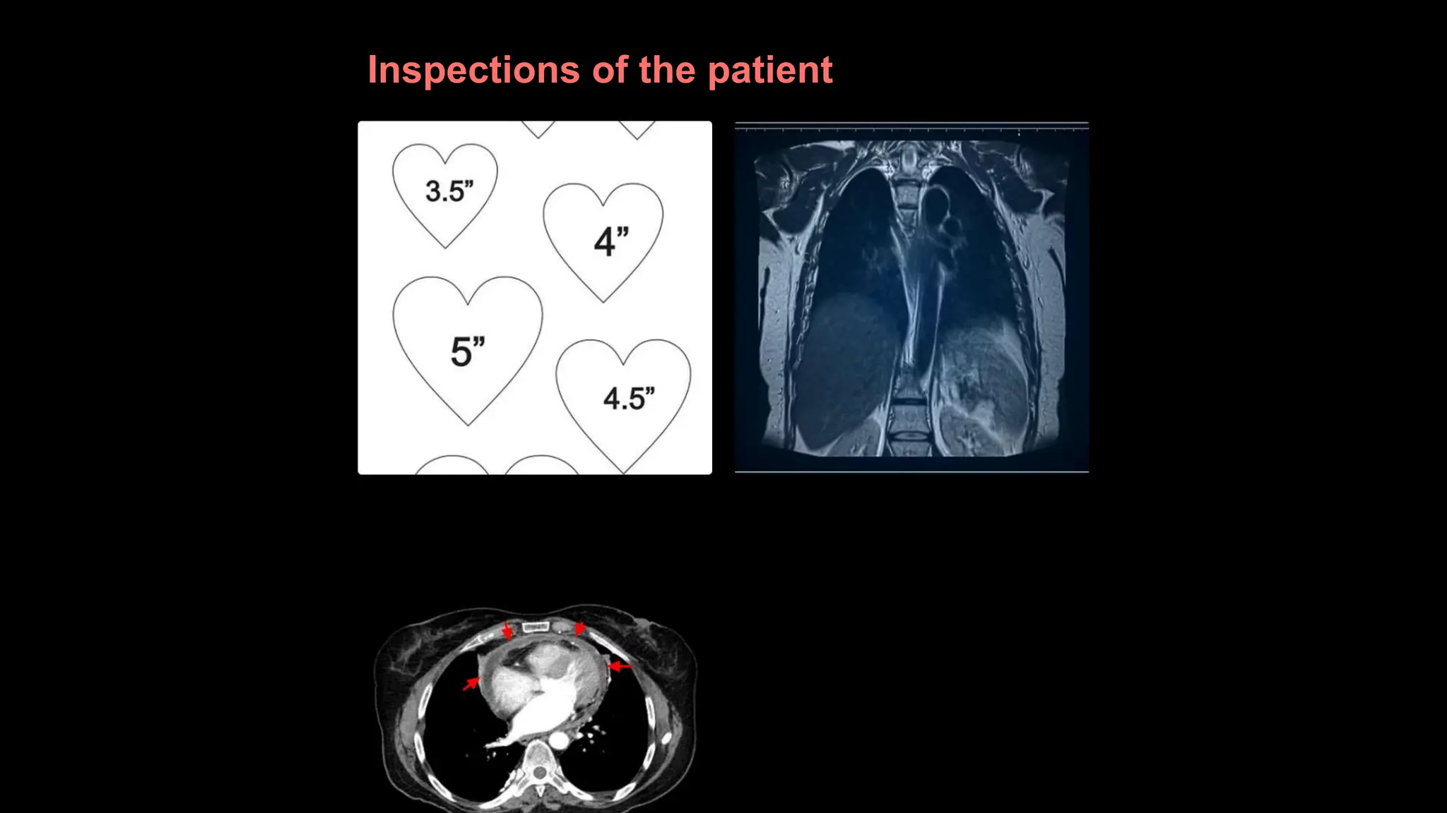 Introduction-to-Cardiovascular-Examination.pptx