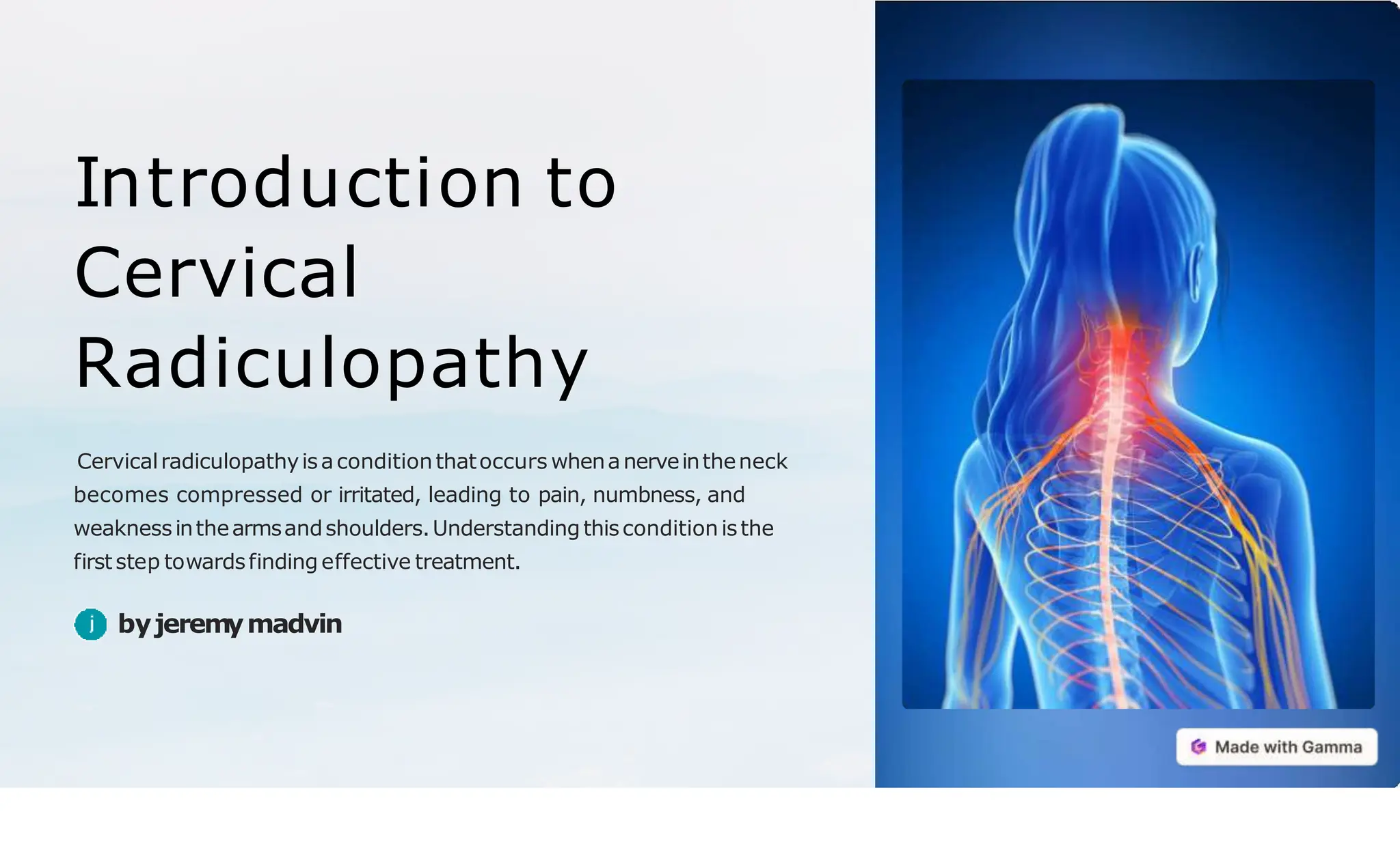 Cervical Radiculopathy Treatment - pinched nerve device | PPTX