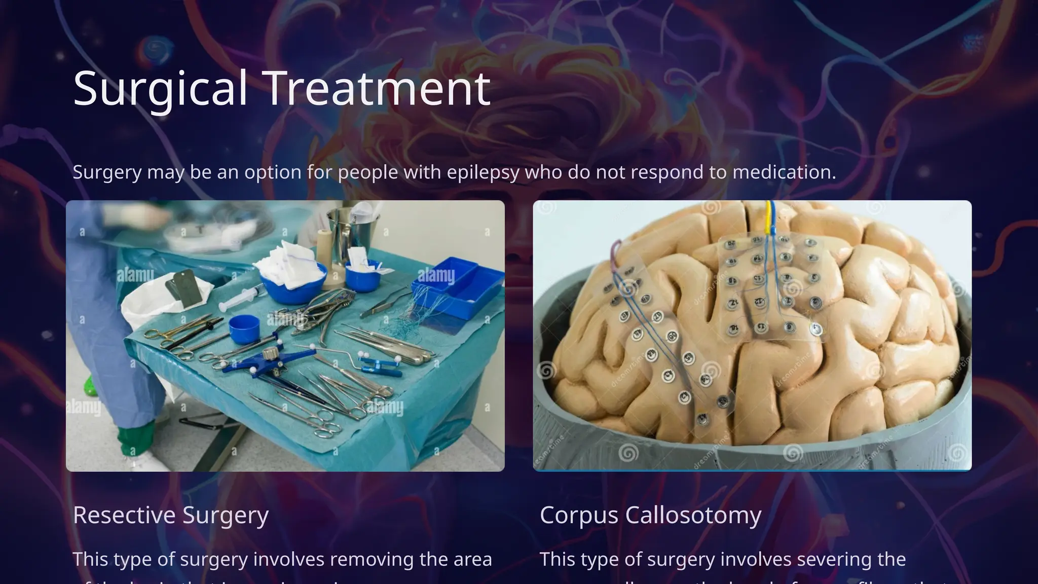 Introduction-to-Epilepsy in neuro medicine.pptx