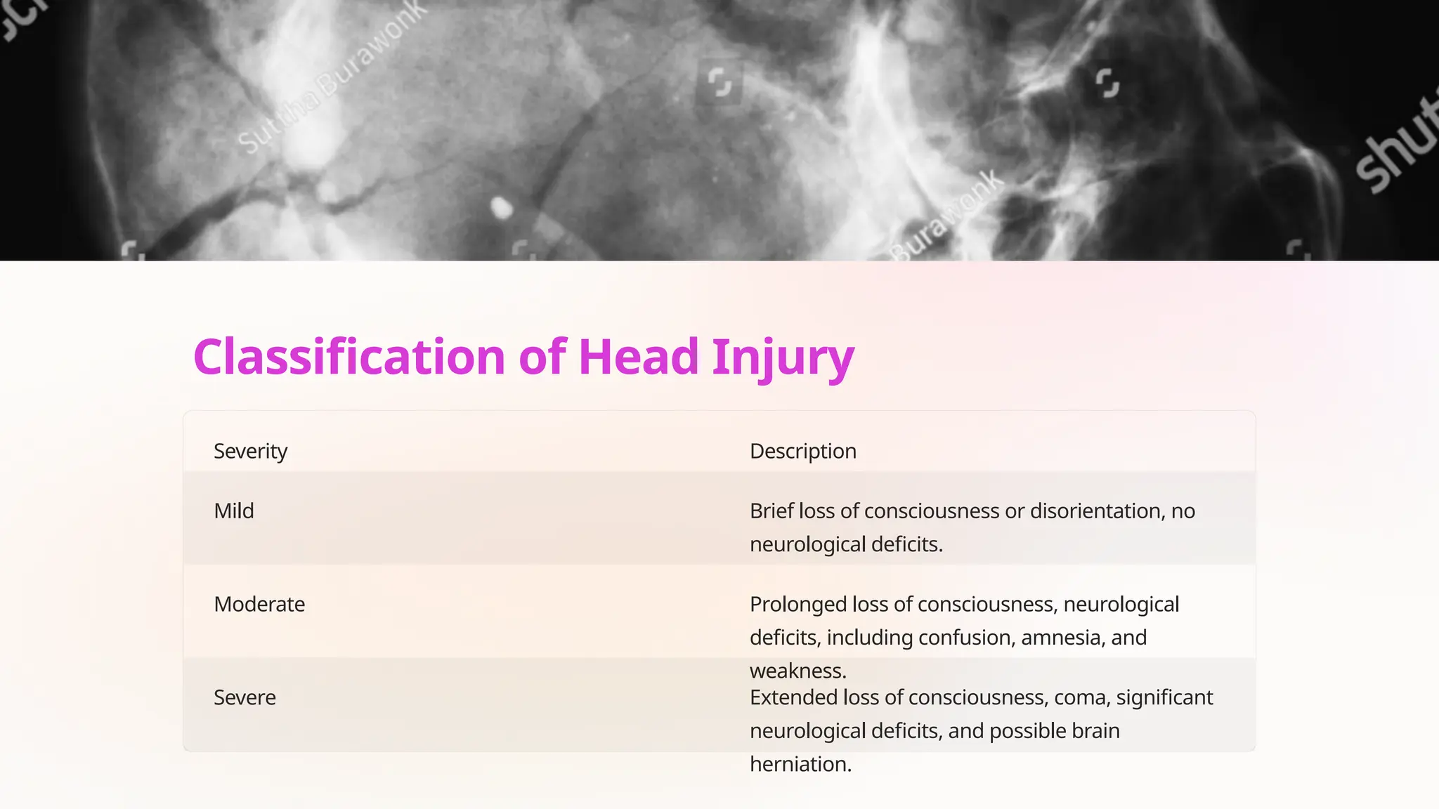 Introduction-to-Head-Injury in neuro .pptx