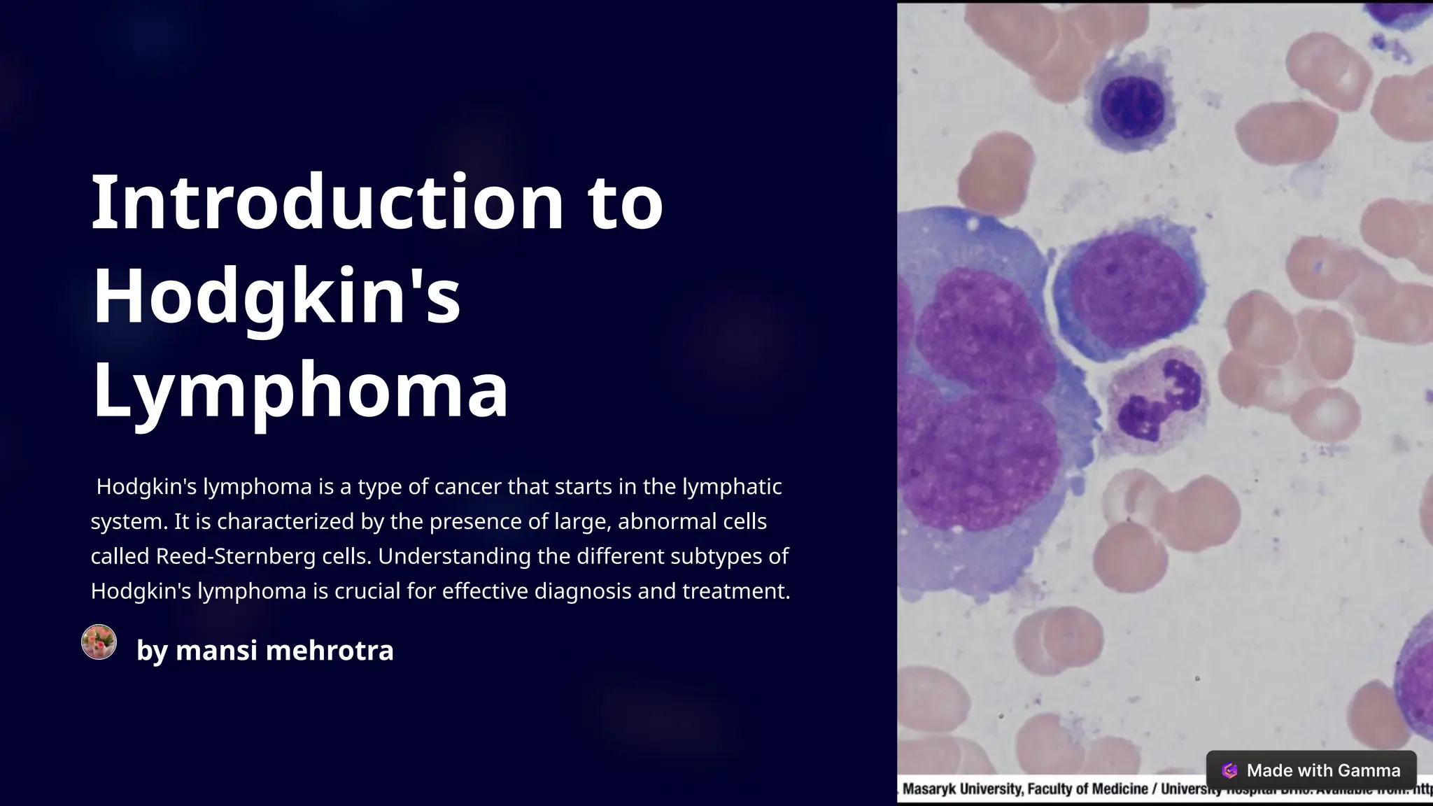 Hodgkins lymphoma introduction to lymphoma | PPTX
