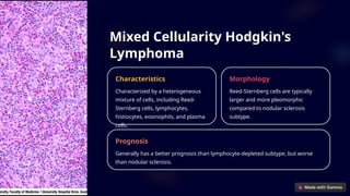Hodgkins lymphoma introduction to lymphoma | PPTX