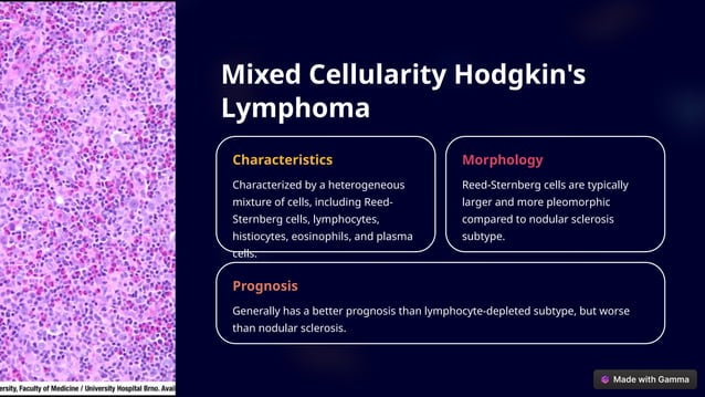 Hodgkins lymphoma introduction to lymphoma | PPTX