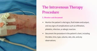 Mastering the Art of Setting up an IV Drip: A Step-by-Step Guide | PDF