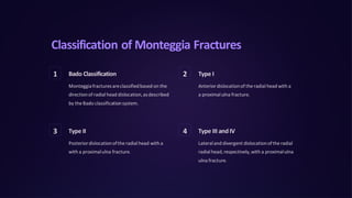 introduction to Monteggia Fractures------ | PPT