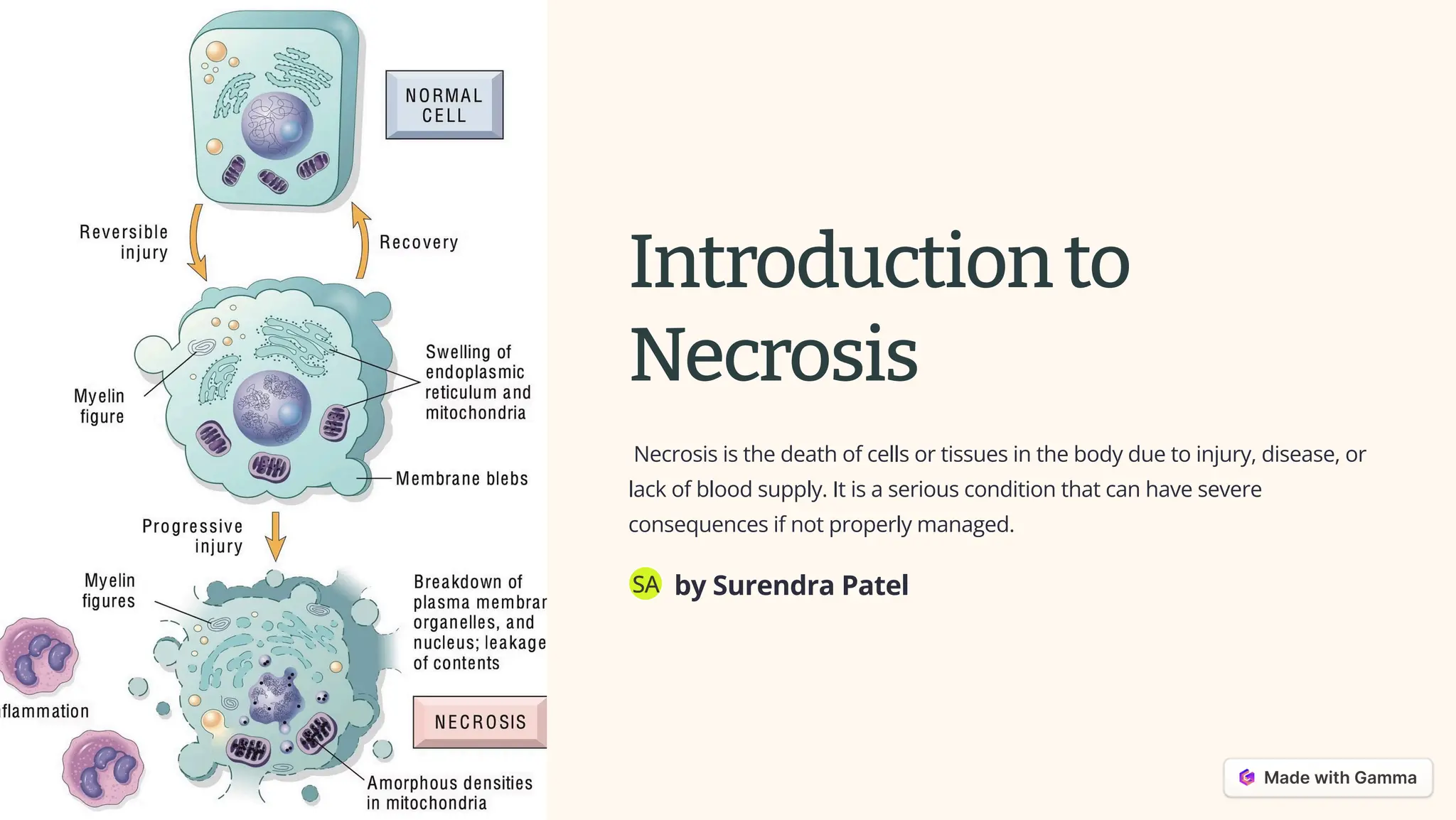 Introduction to Necrosis ,Cell death: necrosis, injury, infection. | PDF